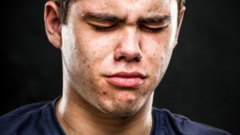 Top 3 Best Face Wash For Teen Boys (All Skin Types)